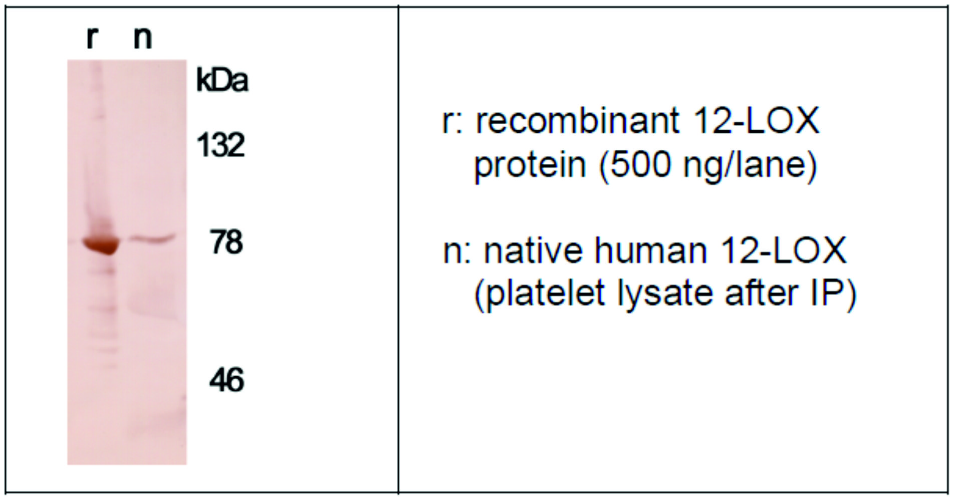 murine MAb against human 12-Lipoxygenase (12-LOX/ALOX12), Clone 25.20